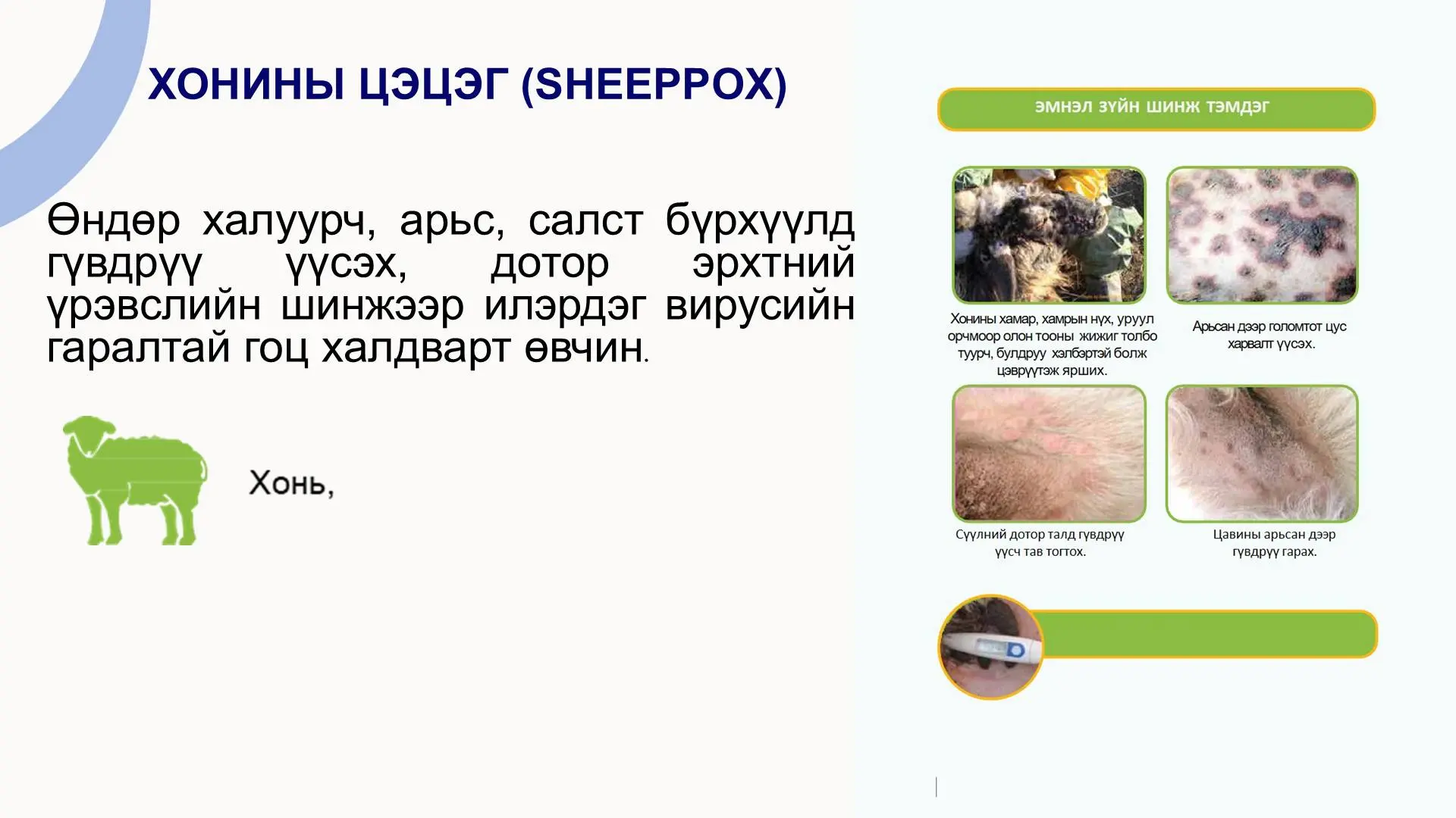 ХОНИНЫ ЦЭЦЭГ ӨВЧИН ГЭЖ ЮУ ВЭ ᠬᠣᠨᠢᠨ ᠤ᠋ ᠴᠡᠴᠡᢉ ᠡᠪᠡᠳᠴᠢᠨ ᢉᠡᠵᠦ ᠶᠠᠭᠤ ᠪᠤᠢ